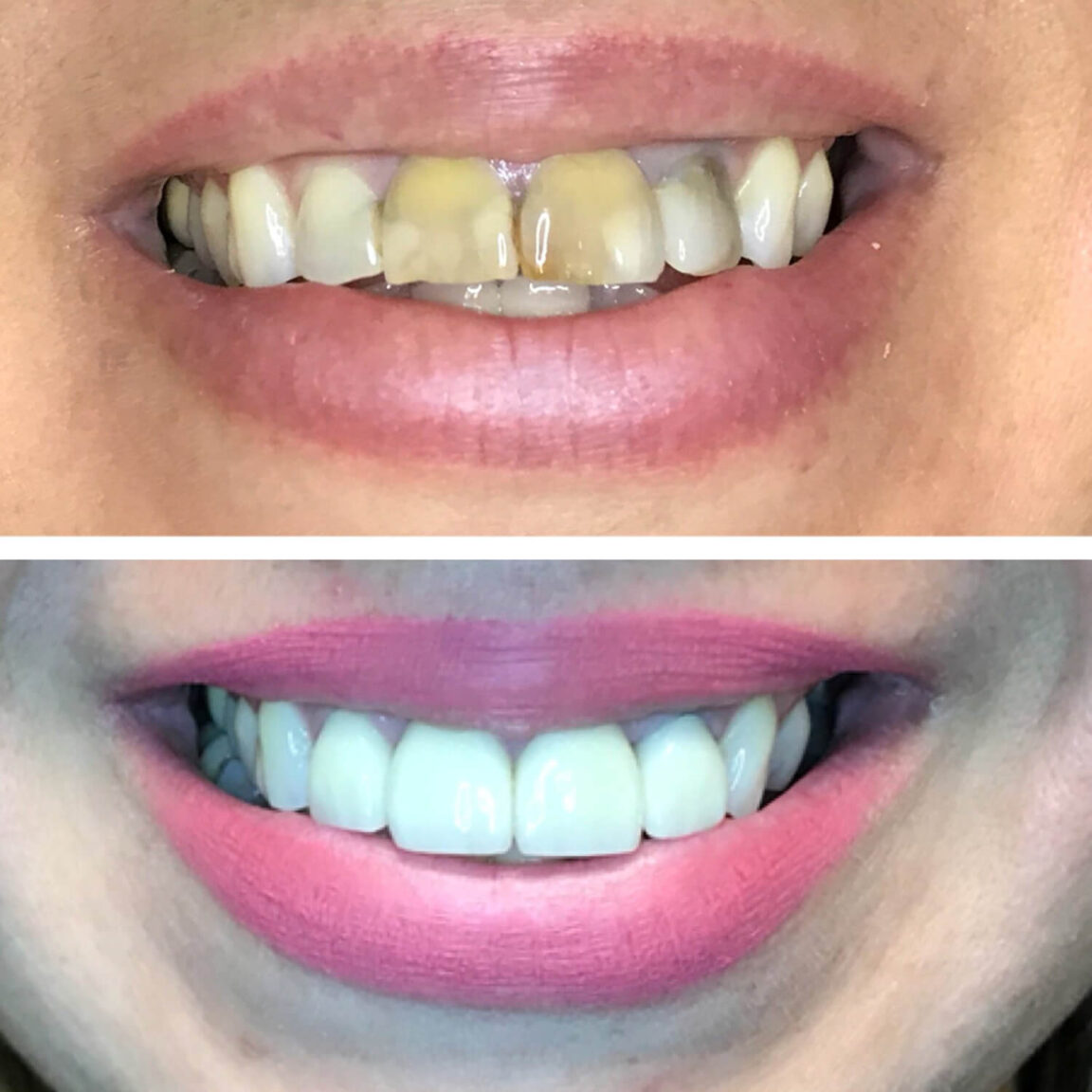 Smile Gallery - Woolf Dental